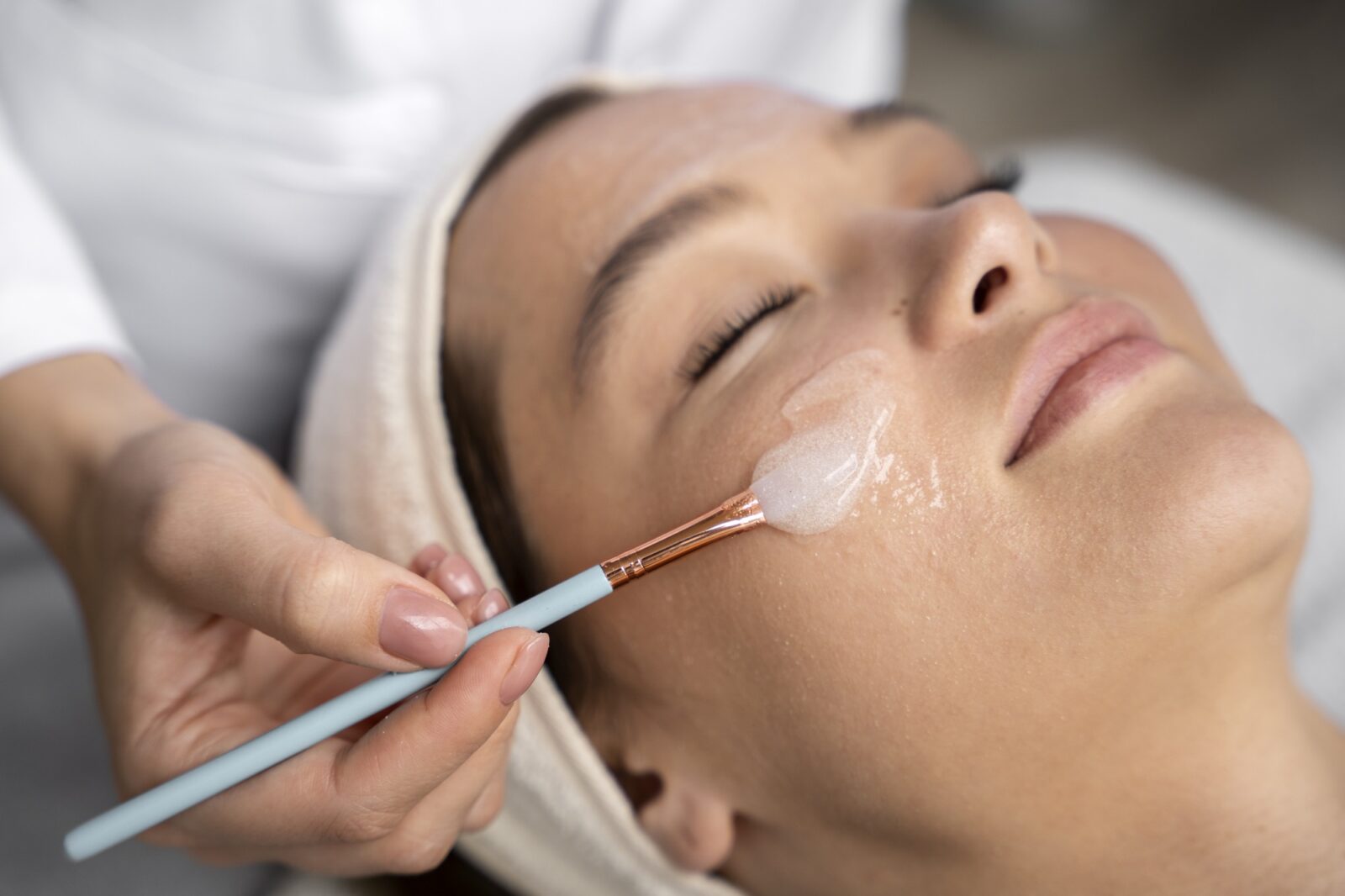 Chemical Peel Derby | Chemical Peel Near Me | Chemical Peels